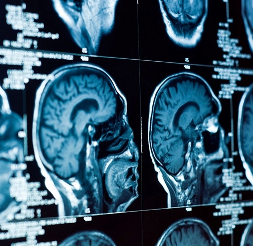 Giá chụp MRI sọ não hiện tại là bao nhiêu?