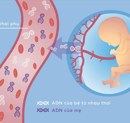 Xét nghiệm NIPT 7 giúp sàng lọc những dị tật nào?Đối tượng nào...